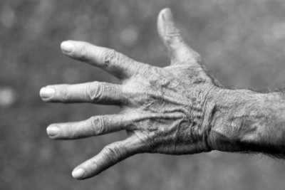 Is Knuckle Cracking Bad?